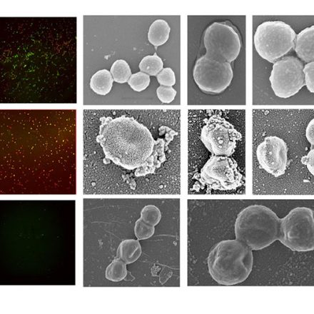 Científicos de Córdoba crean superficie que previene infecciones ...